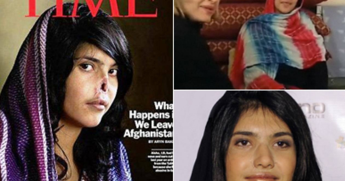 Το μαρτύριο της Bibi Aisha, θα έχει τέλος; - Newsbomb