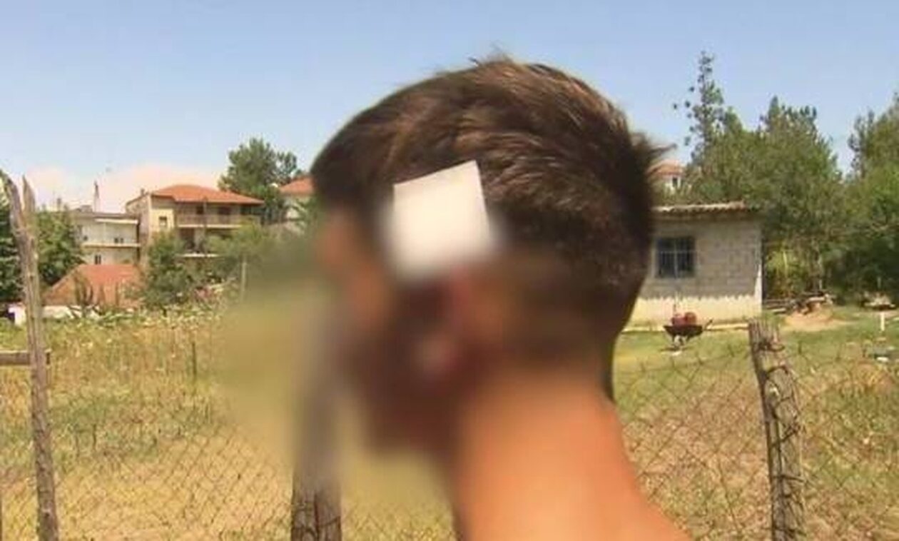 Χαλκιδική: «Ένιωσα μία σφαίρα και το κεφάλι μου γεμάτο αίματα ...